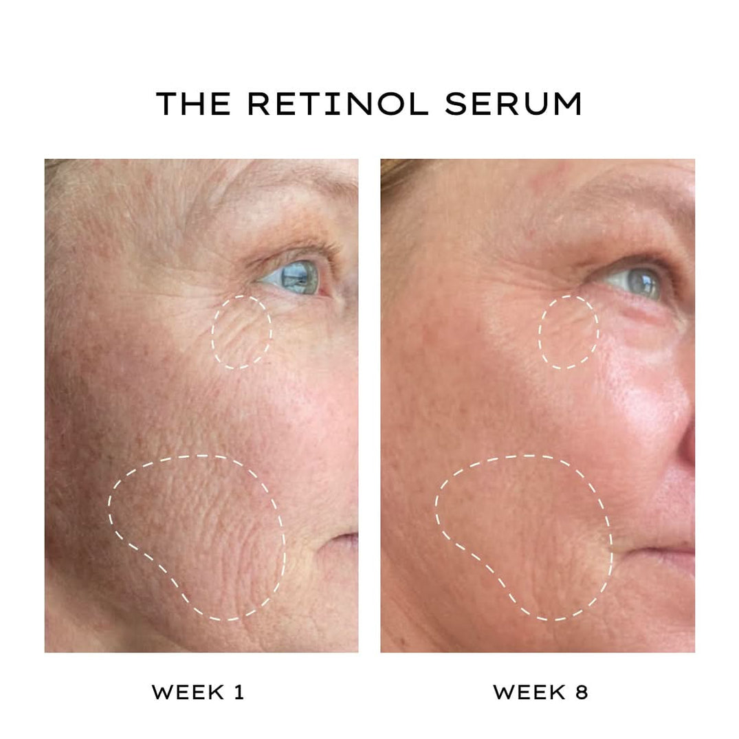 The Retinol Serum l MANTLE